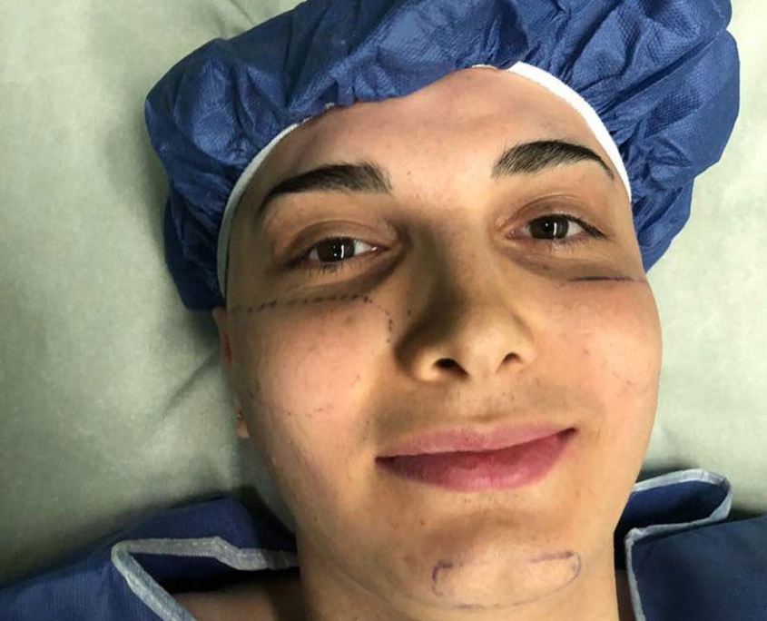 Swedish Preschool Teacher Gets Hair Transplant, Lipo in Iran