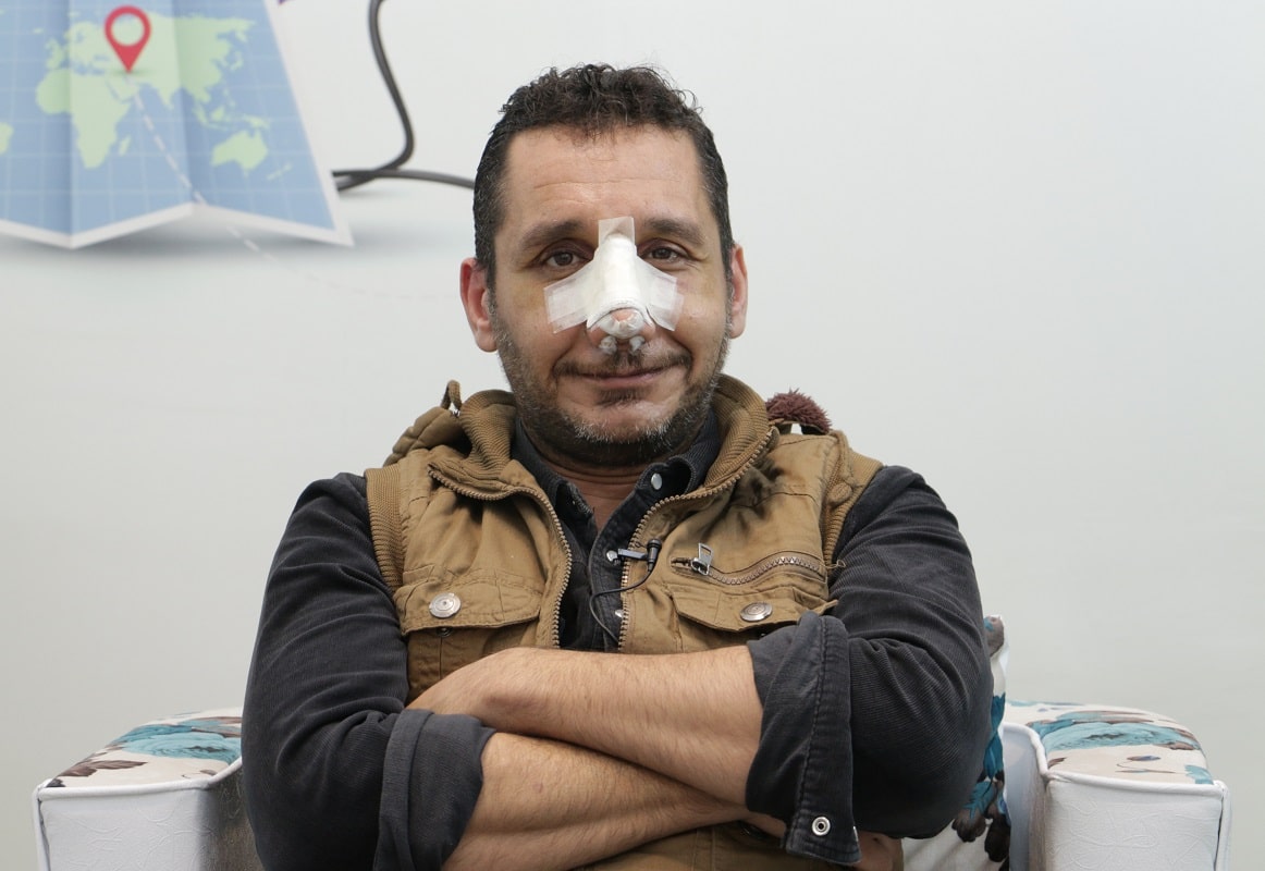 Iraqi Patient Underwent Nose Surgery to Correct Nasal Septum Deviation