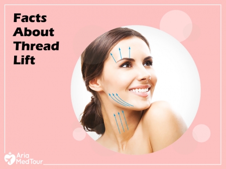 8 Facts About Thread Lift You Need to Know | AriaMedTour