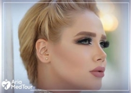 Nose Job Before and After Photos (2022) - Iran | AriaMedTour