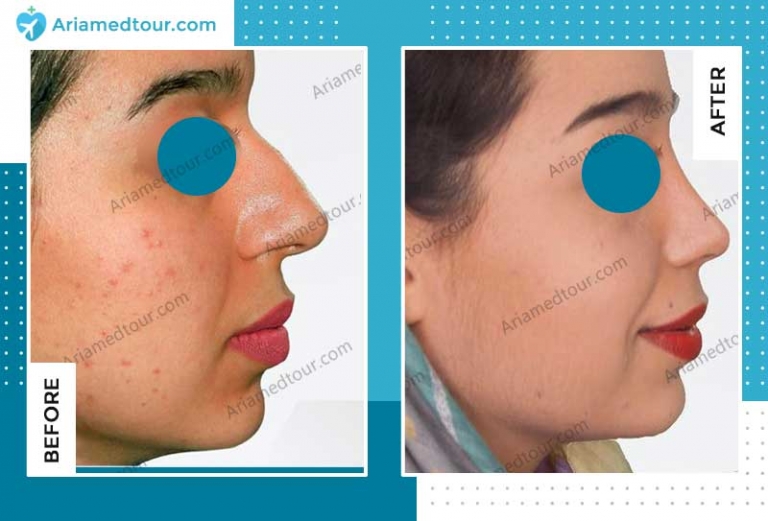 Dr. Saman - Plastic Surgeon & ENT specialist in Iran & Sweden