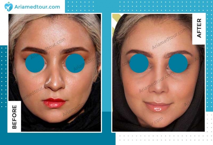 Dr. Saman - Plastic Surgeon & ENT specialist in Iran & Sweden