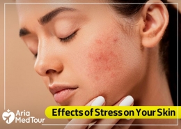 How Stress Can Affect Your Skin - AriaMedTour