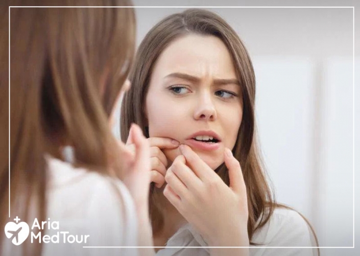 How Stress Can Affect Your Skin - AriaMedTour