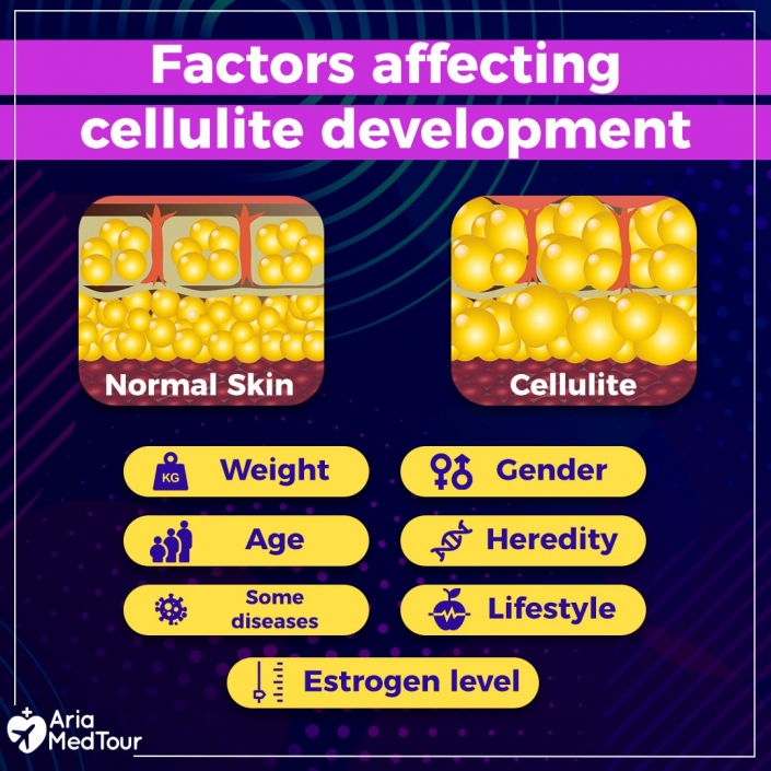 How to Get Rid of Cellulite? - 6 Effective Cellulite Treatments