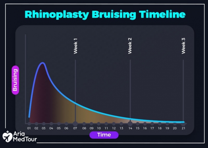 Everything You Need To Know About Bruising After Rhinoplasty