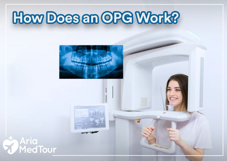 Dental OPG: Complete Guide to Panoramic X-rays for Dentistry