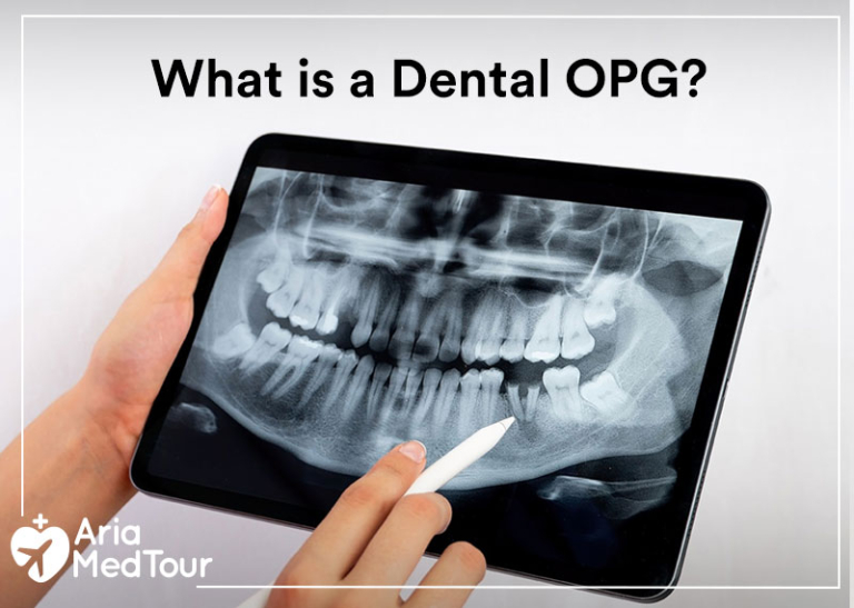 Dental OPG: Complete Guide to Panoramic X-rays for Dentistry